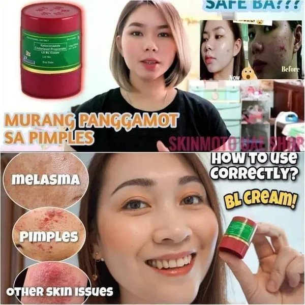 LS BL Cream 7g Treat Skin Fungal Infections, Inflammation & Irritation ...