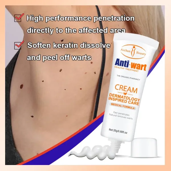 Aichun Beauty Anti-Wart Cream 20 GM | SY Bazzar